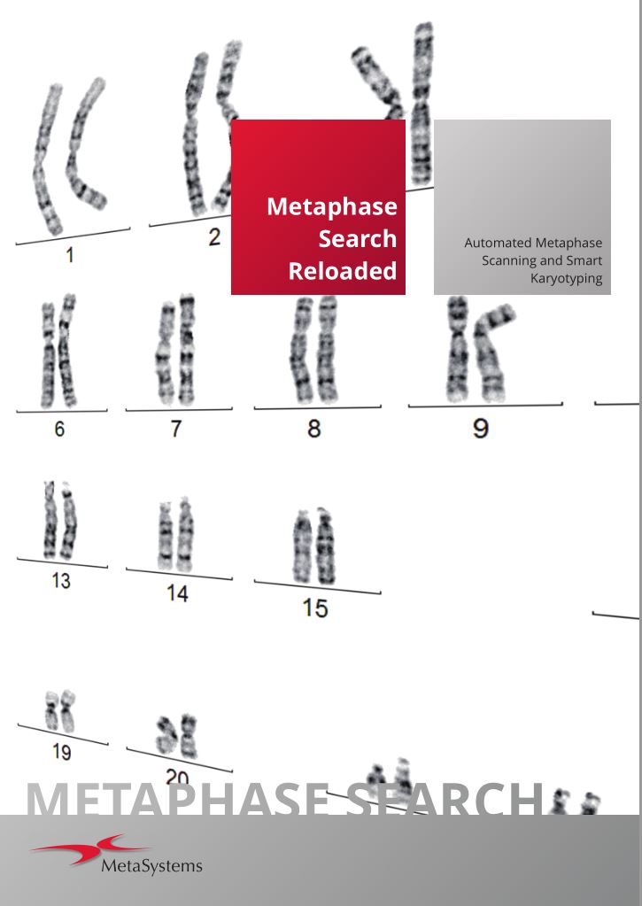 Ikaros Karyotyping System | MetaSystems