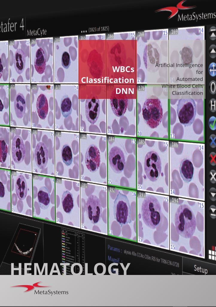 Metafer Slide Scanning Platform | MetaSystems